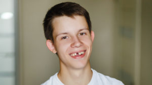 What to Do When a Tooth Is Knocked Out: Your Guide